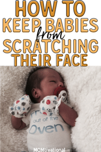 How To Keep Babies From Scratching Face - MOMtivational