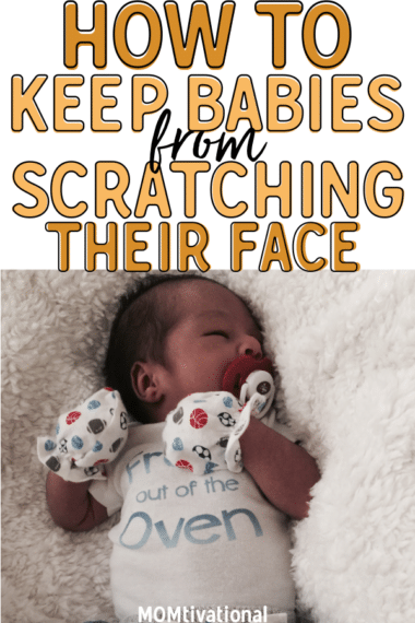 How To Keep Babies From Scratching Face - MOMtivational