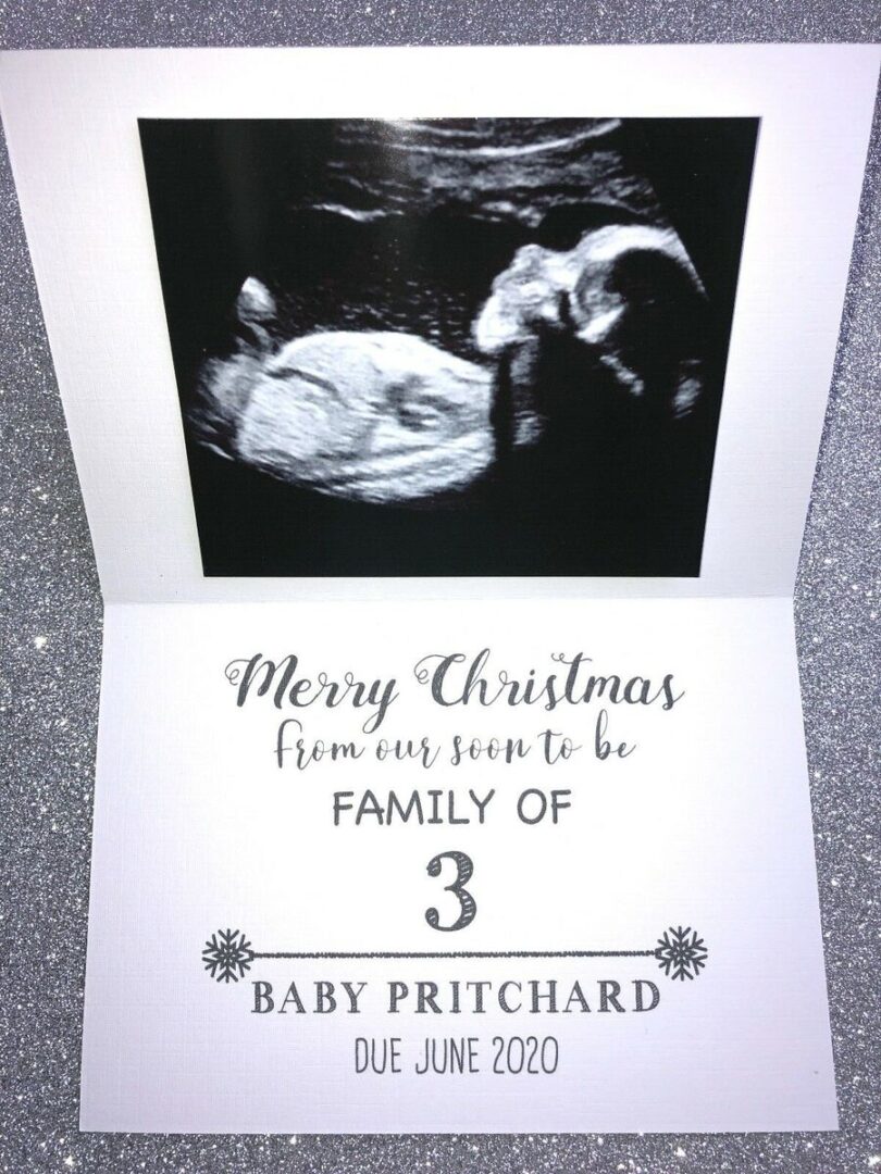 33+ Adorable Baby Christmas Announcement Ideas to Melt Hearts ...